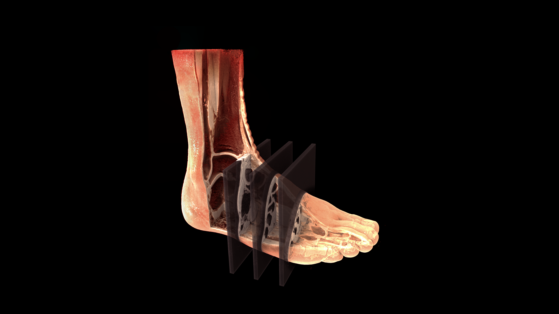 Musculoskeletal Imaging - Siemens Healthineers