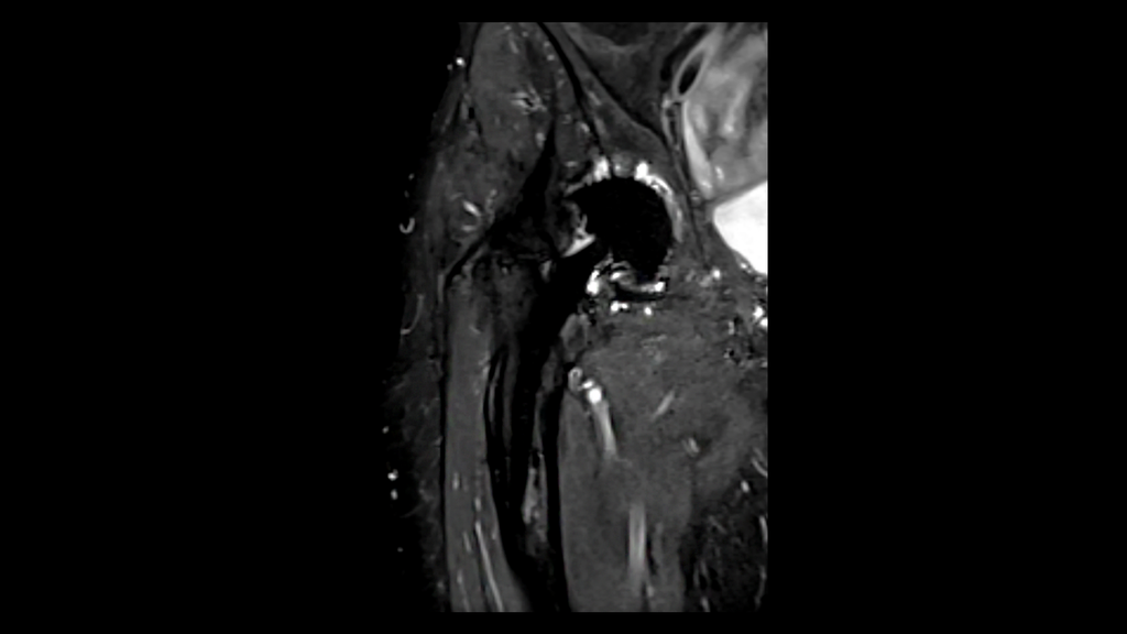 Musculoskeletal Imaging - Siemens Healthineers USA