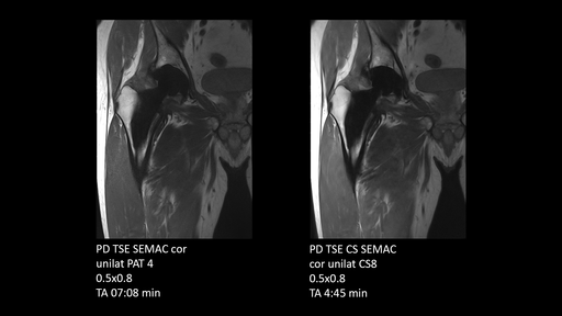 Musculoskeletal Imaging - Siemens Healthineers USA