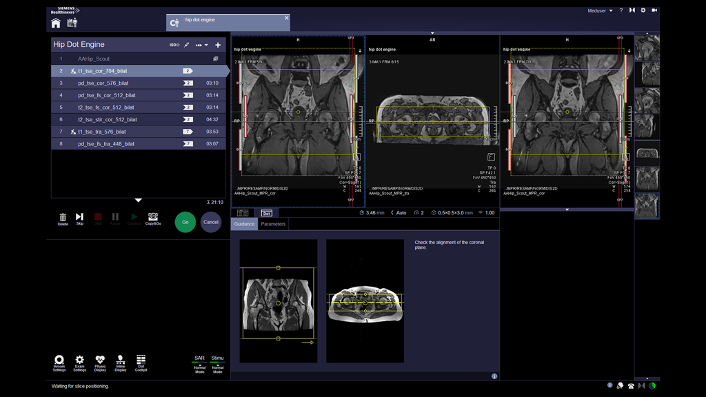 Musculoskeletal Imaging - Siemens Healthineers USA
