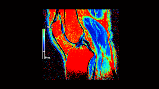 Musculoskeletal Imaging - Siemens Healthineers USA