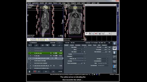 Whole-body MRI at 1.5T – Step-by-Step - Siemens Healthineers