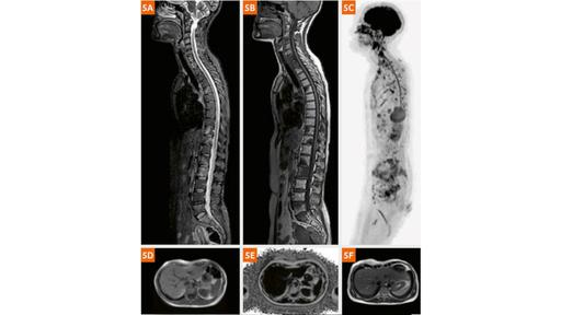 Whole-body MRI at 1.5T – Step-by-Step - Siemens Healthineers