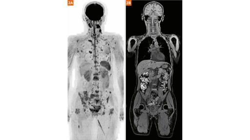 Whole-body MRI at 1.5T – Step-by-Step - Siemens Healthineers
