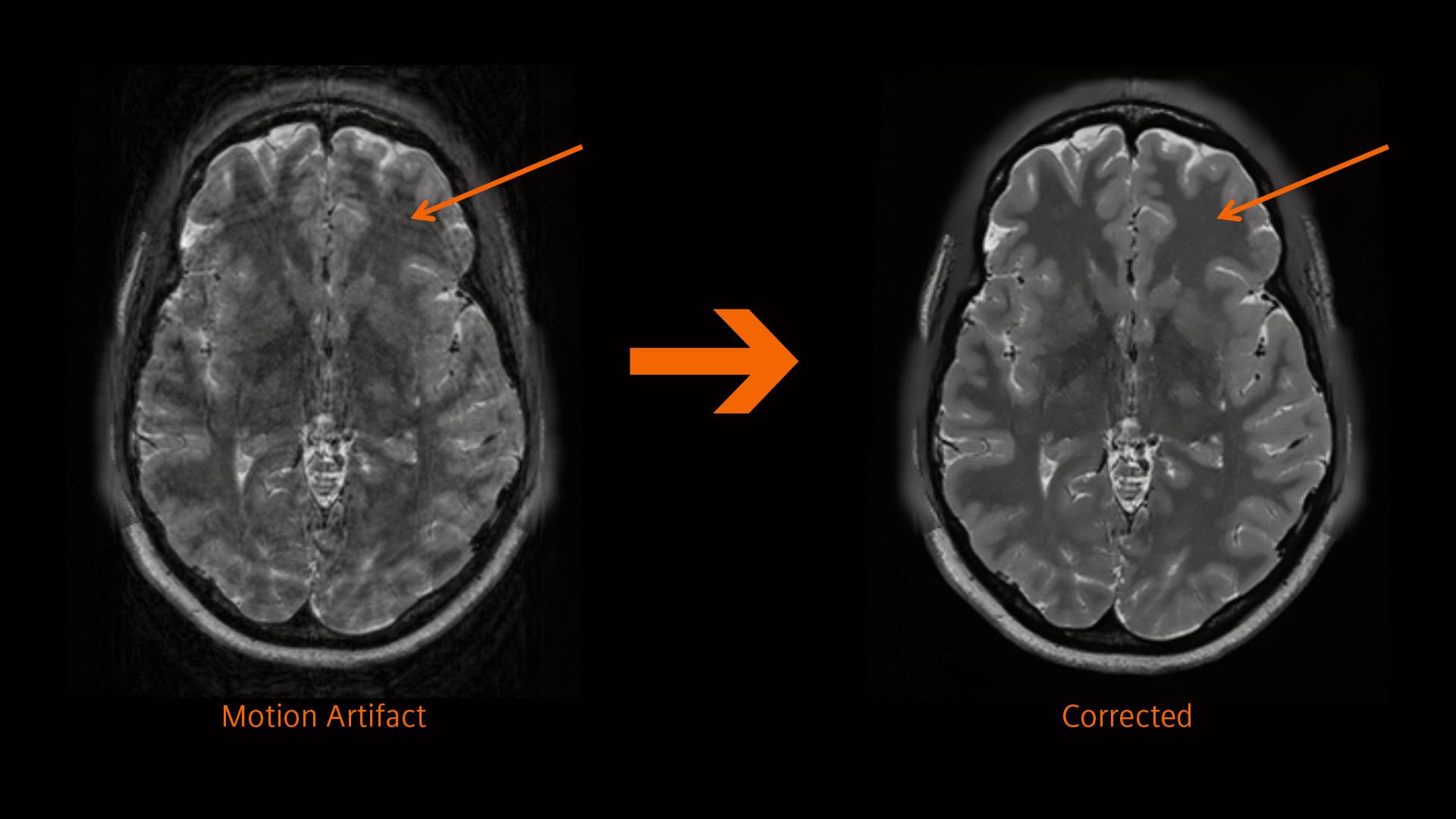 Aritificial Intelligence in Radiology - Siemens Healthineers