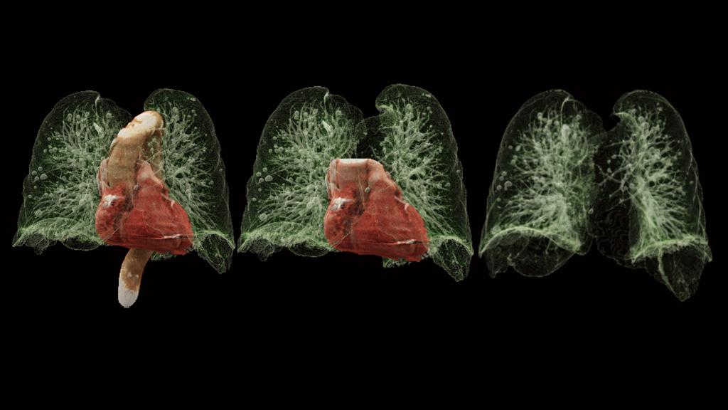 Diagnostic Imaging Technology - Siemens Healthineers USA