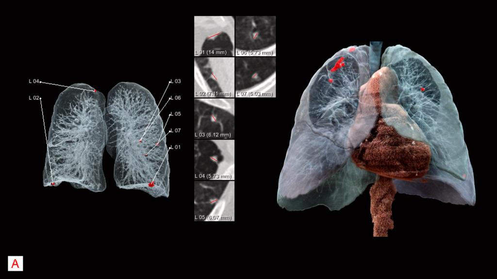 Diagnostic Imaging Technology - Siemens Healthineers USA