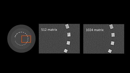 Seven Facts About Precision Matrix on SOMATOM Force - Siemens ...