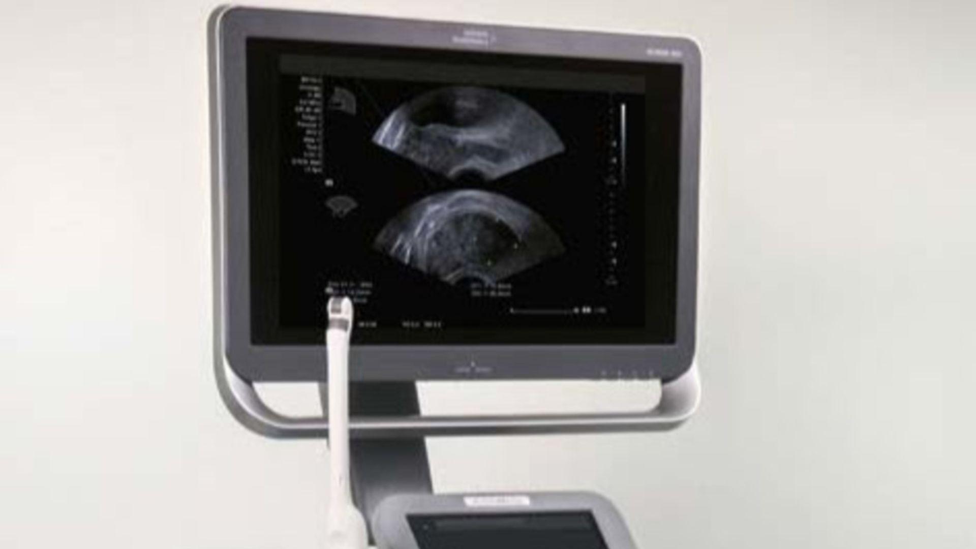 ACUSON NX3 series - Siemens Healthineers Japan