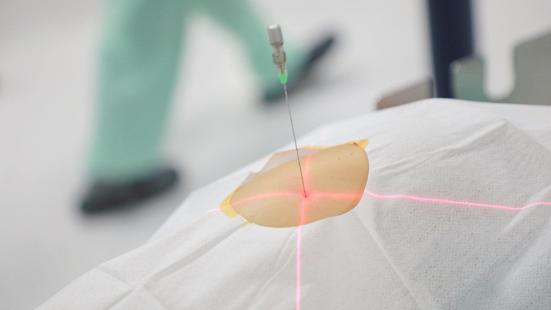 iVATS in the Hybrid OR - Siemens Healthineers