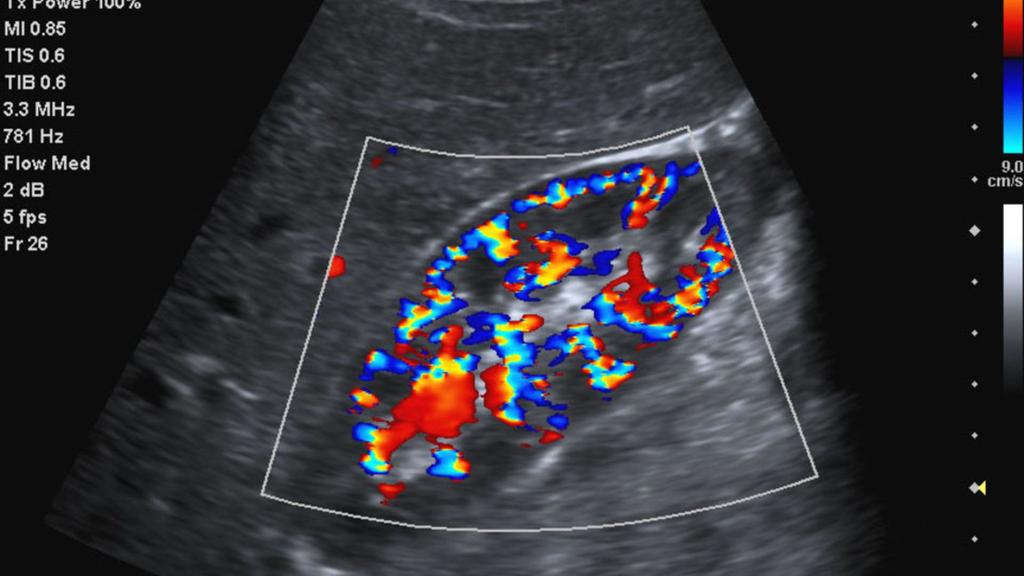 ACUSON P500 Ultrasound System - Siemens Healthineers USA