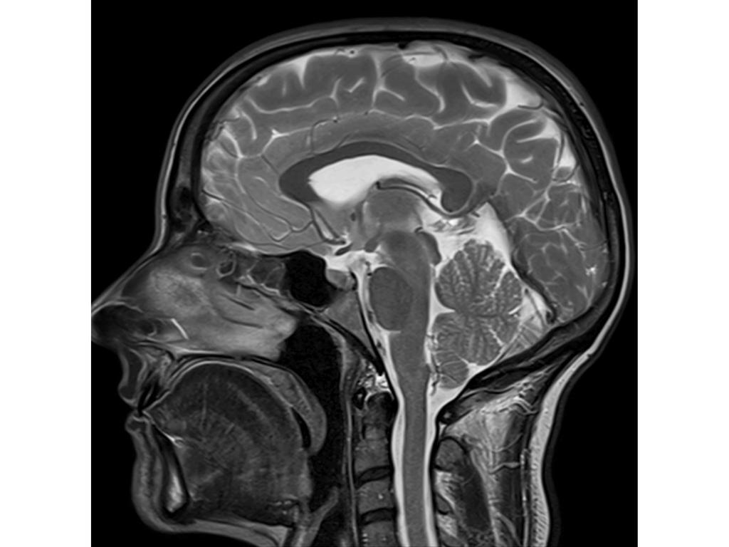 Phoenix Images for MAGNETOM Altea