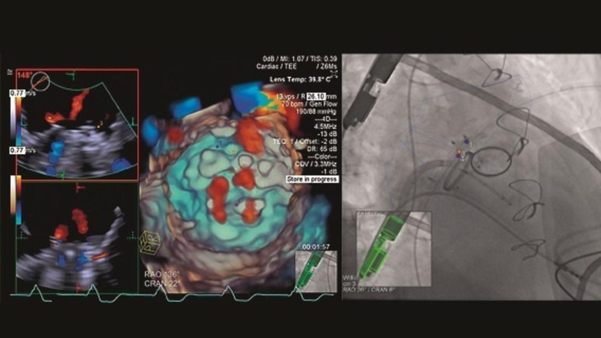 Cardiovascular Ultrasound | ACUSON SC2000 Ultrasound System - Siemens ...