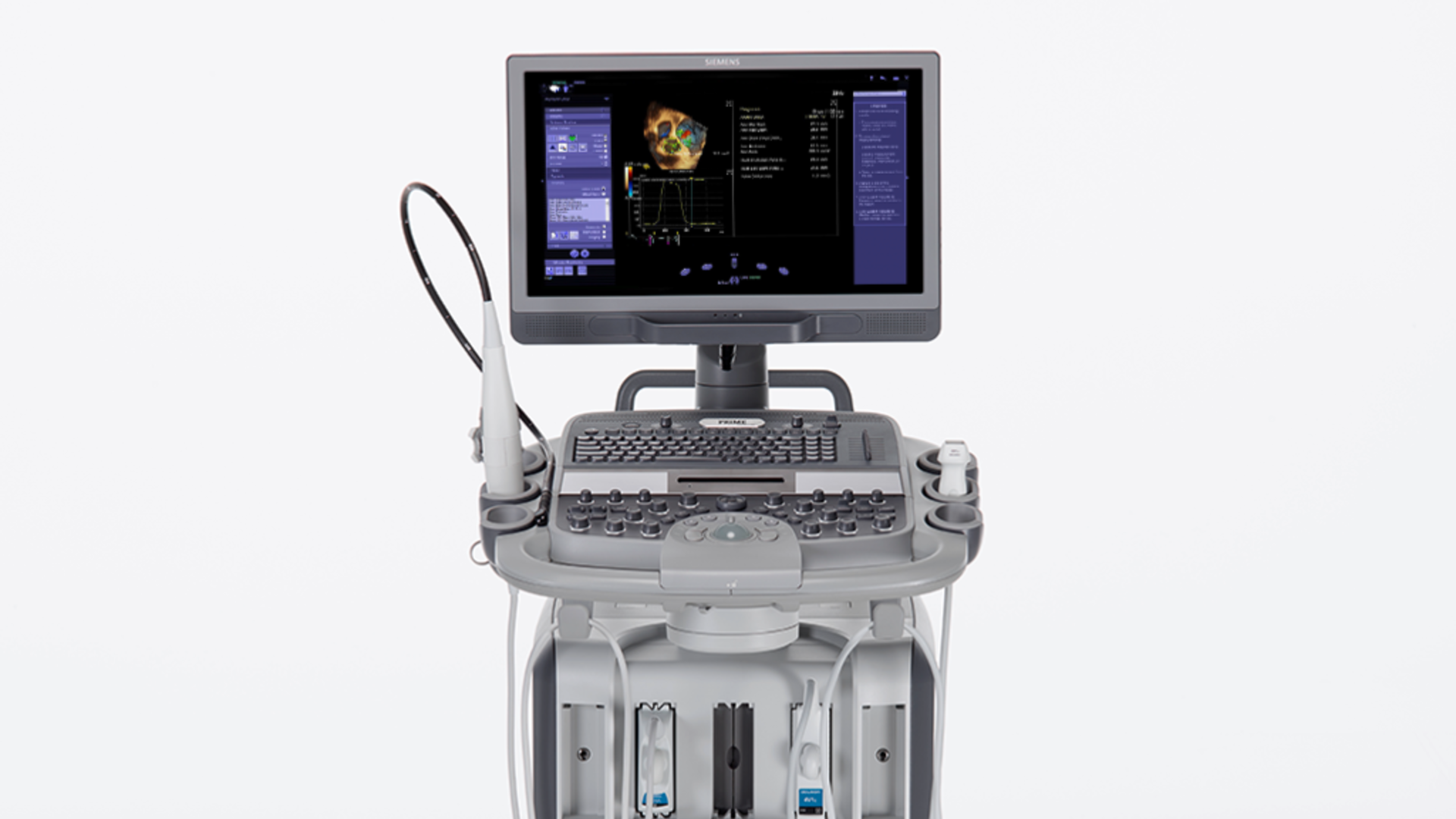 Cardiovascular Ultrasound | ACUSON SC2000 Ultrasound System Siemens ...