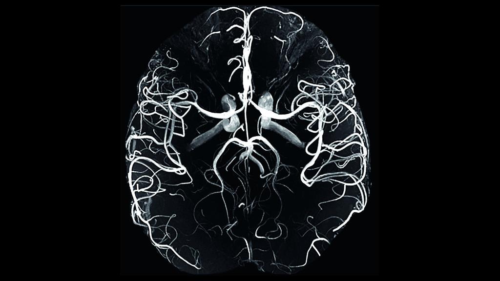 New Directions in the Early Detection of Neurological Diseases