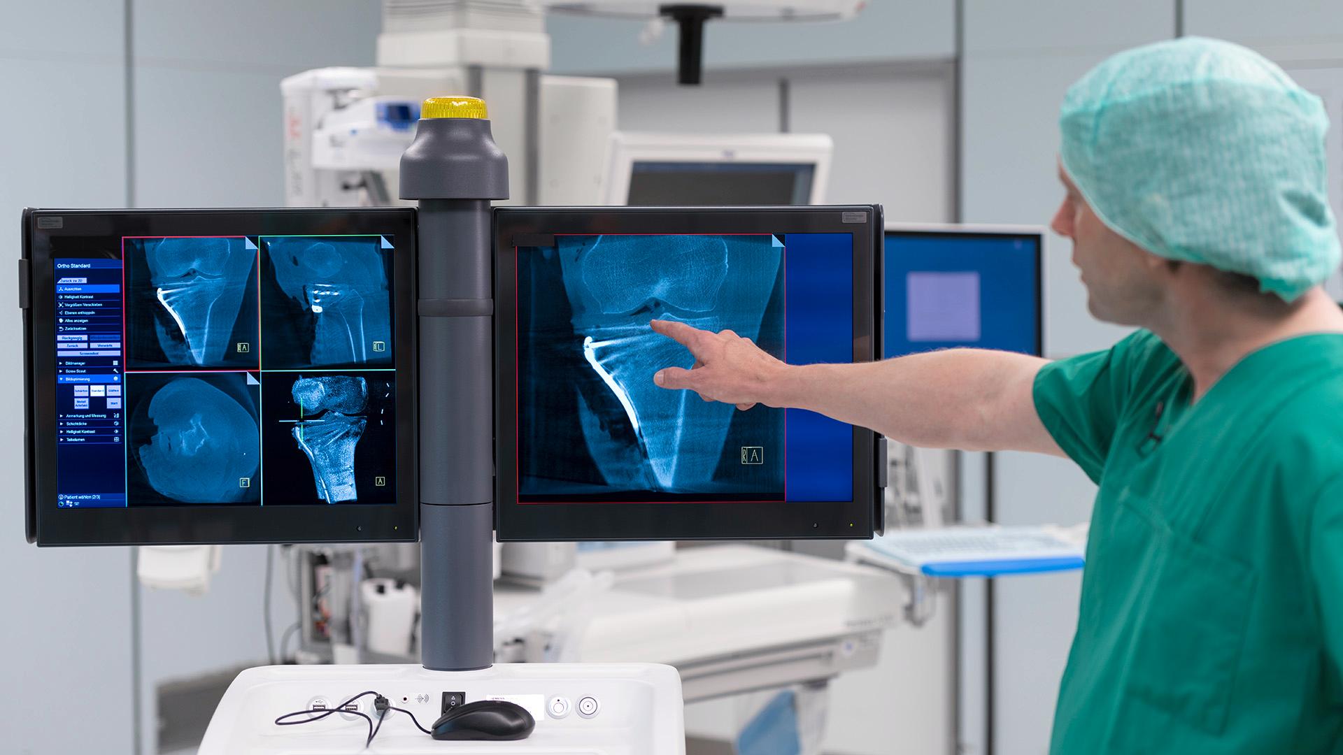Intraoperative 3D imaging in orthopedic trauma surgery - Siemens ...