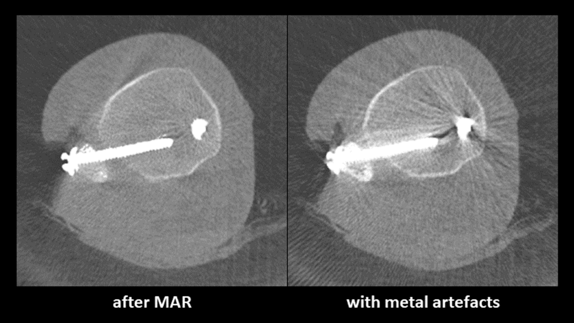Mobile C-arm machine - Cios Spin - Siemens Healthineers Canada