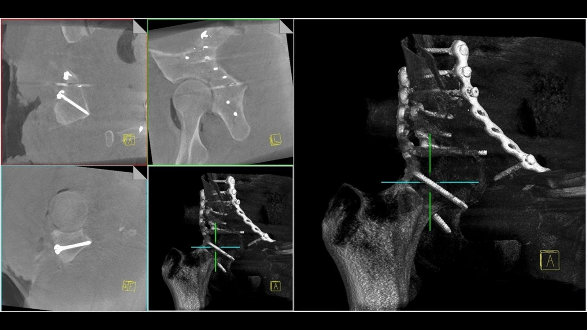 Mobile C-arm machine - Cios Spin - Siemens Healthineers Canada