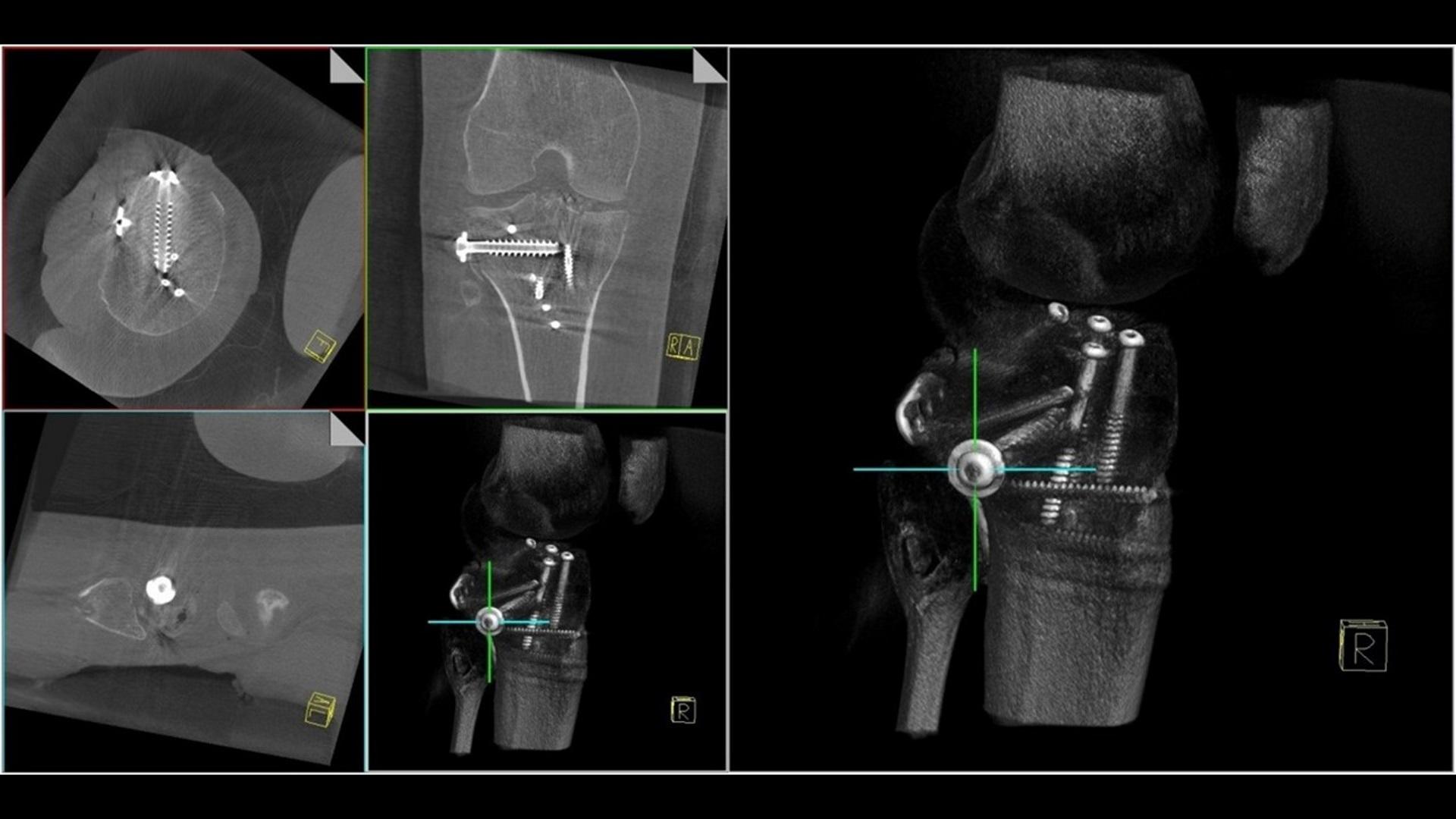 Mobile C-arm machine - Cios Spin - Siemens Healthineers Canada
