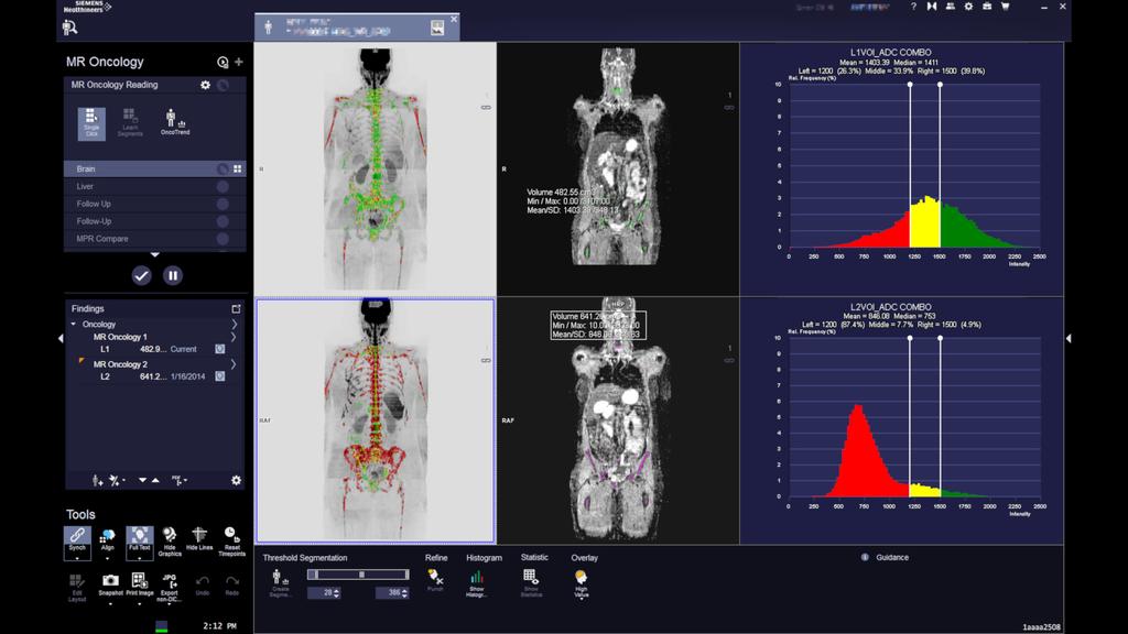 Body MRI - Siemens Healthineers