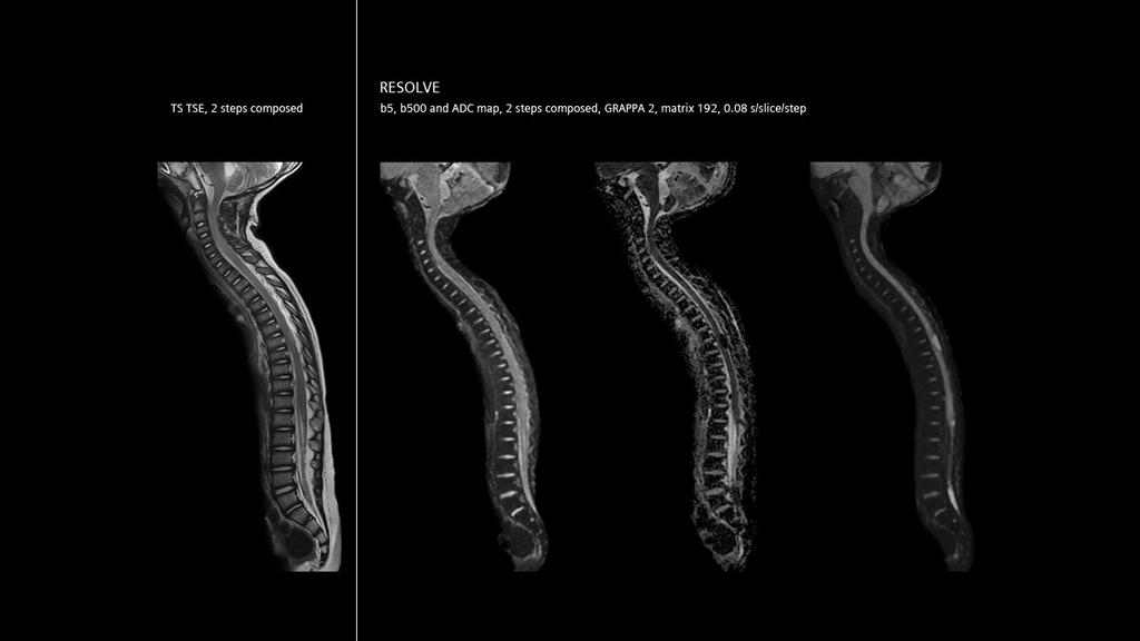 Pediatric MRI - Siemens Healthineers