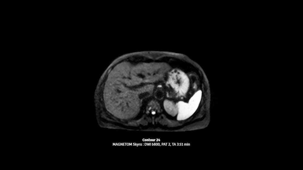 Contour Coils - Siemens Healthineers