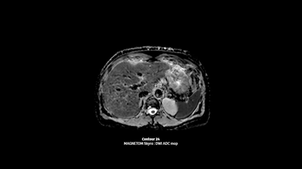 Contour Coils - Siemens Healthineers