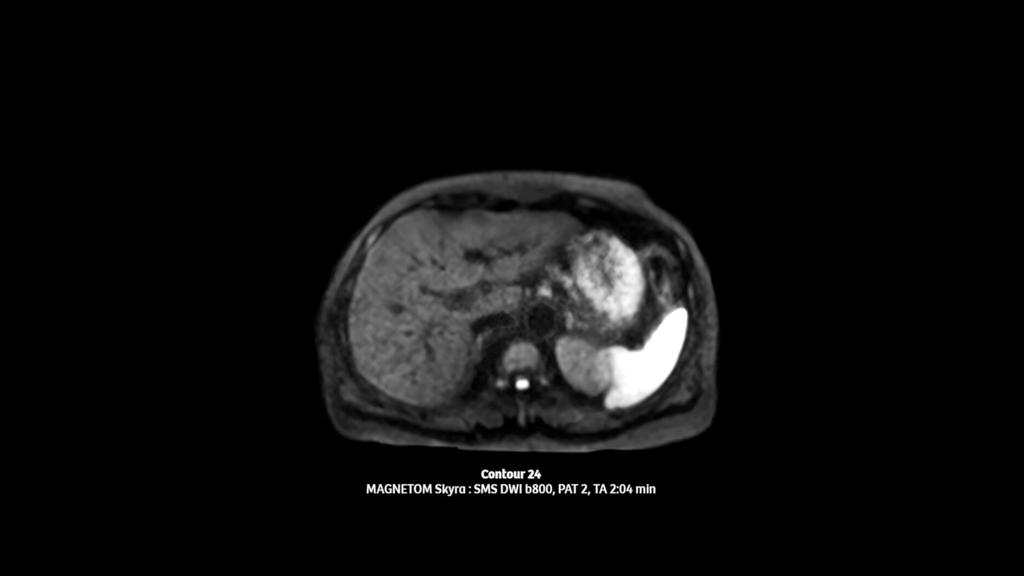 Contour Coils - Siemens Healthineers