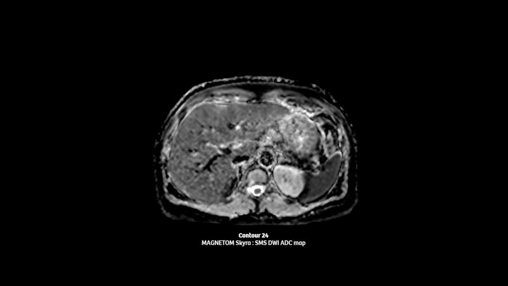 Contour Coils - Siemens Healthineers