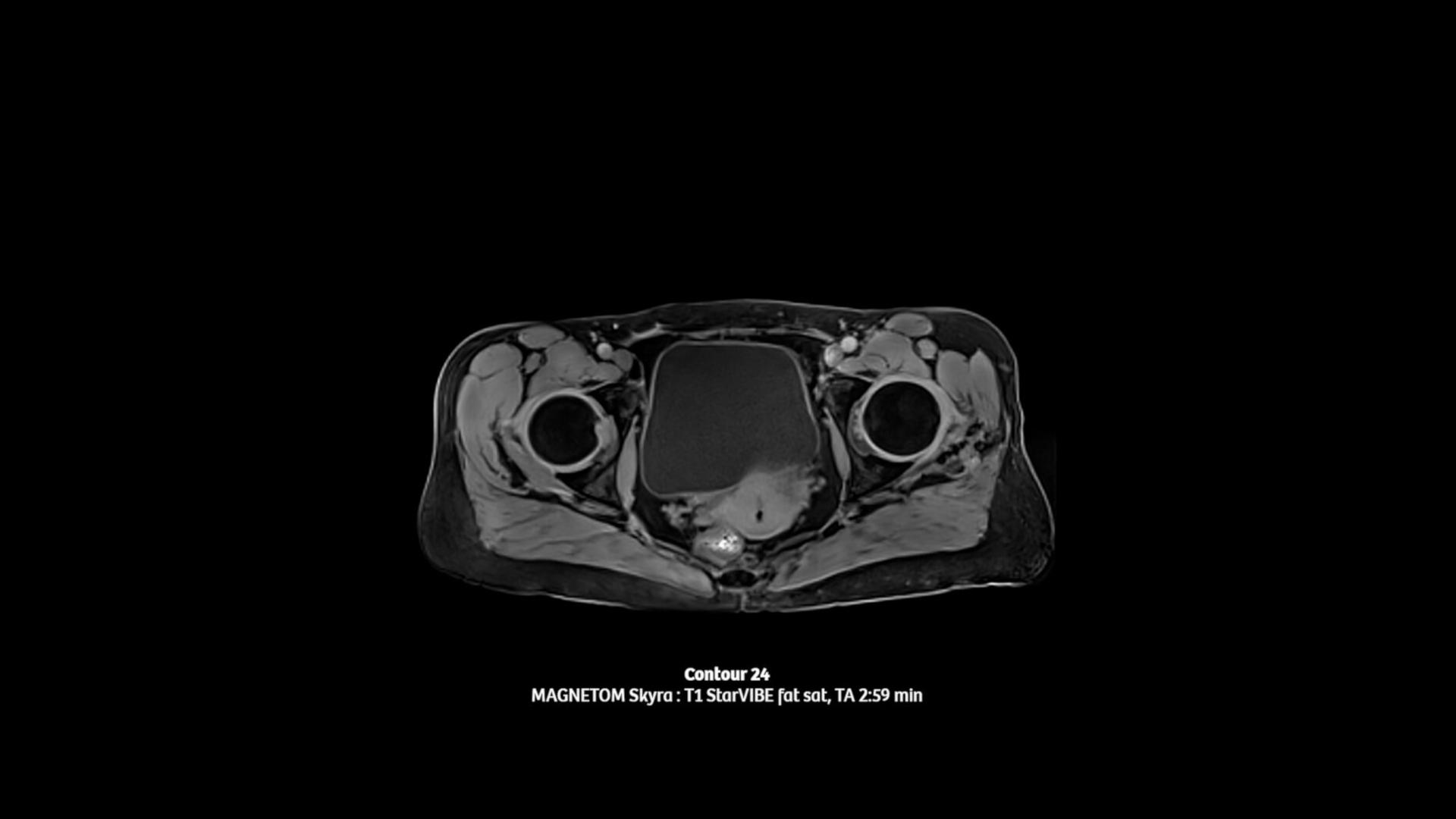 Contour Coils - Siemens Healthineers