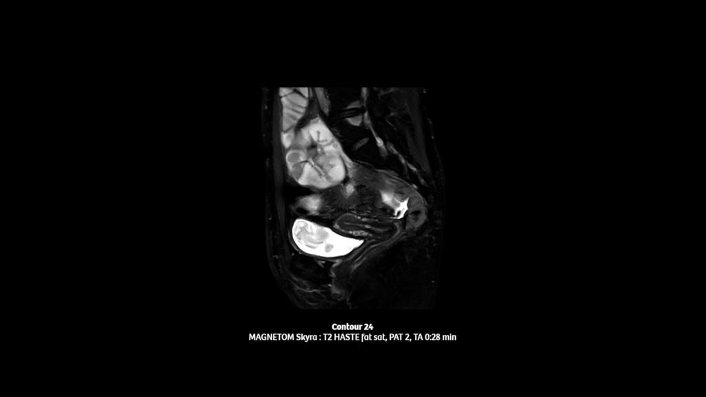 Contour Coils - Siemens Healthineers