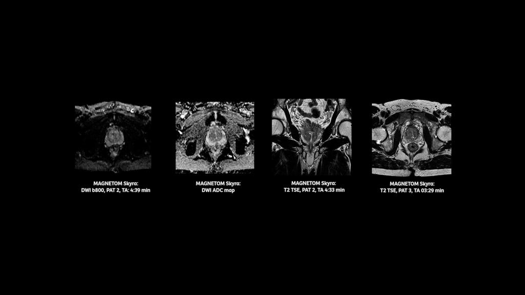 Contour Coils - Siemens Healthineers