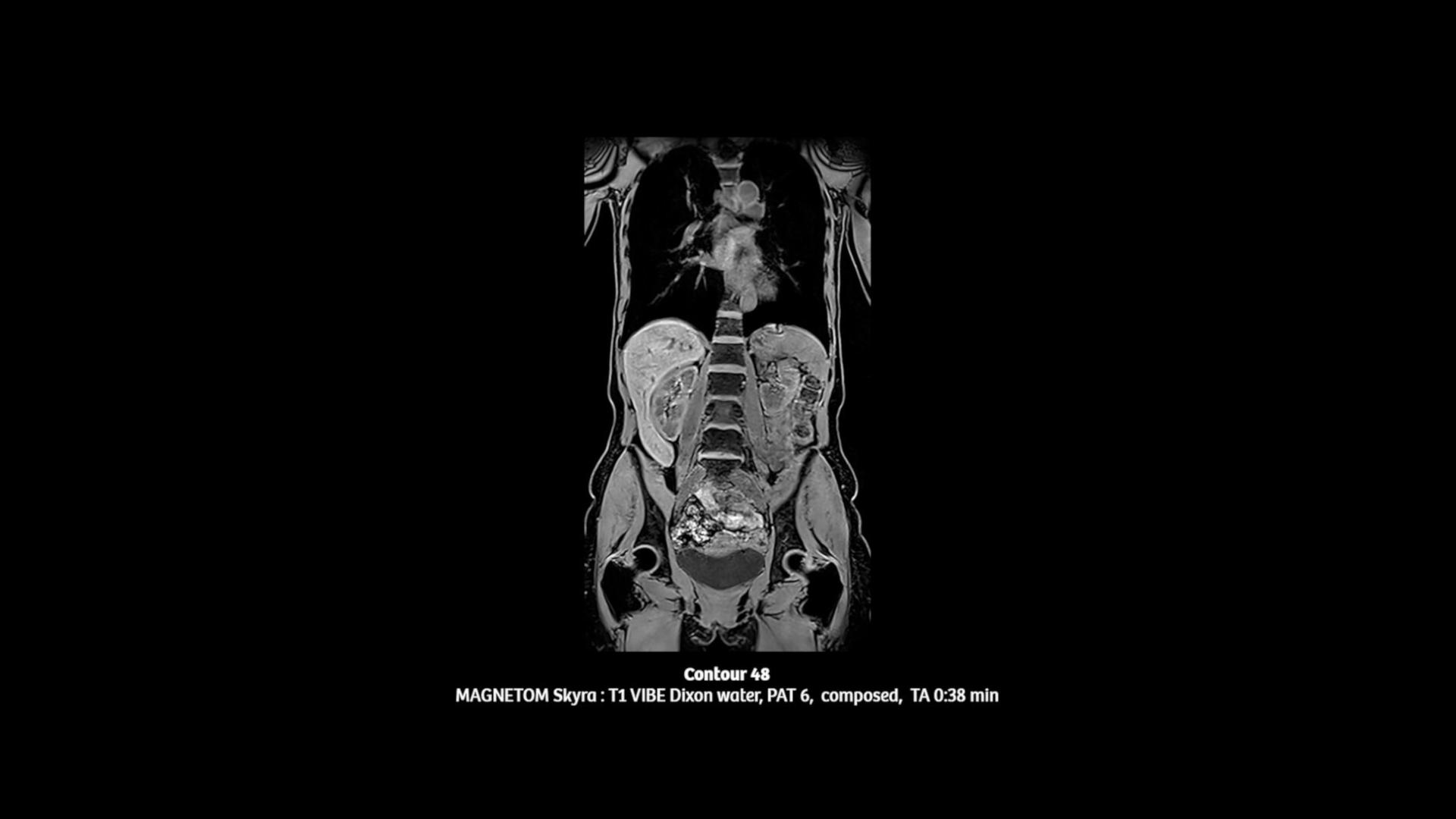 Contour Coils - Siemens Healthineers