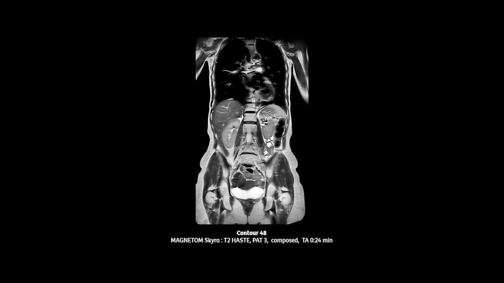 Contour Coils - Siemens Healthineers