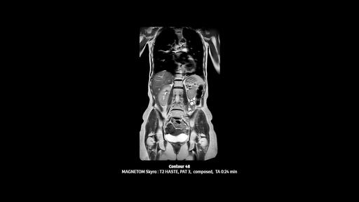 Contour Coils - Siemens Healthineers