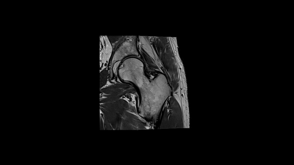 Contour Coils - Siemens Healthineers