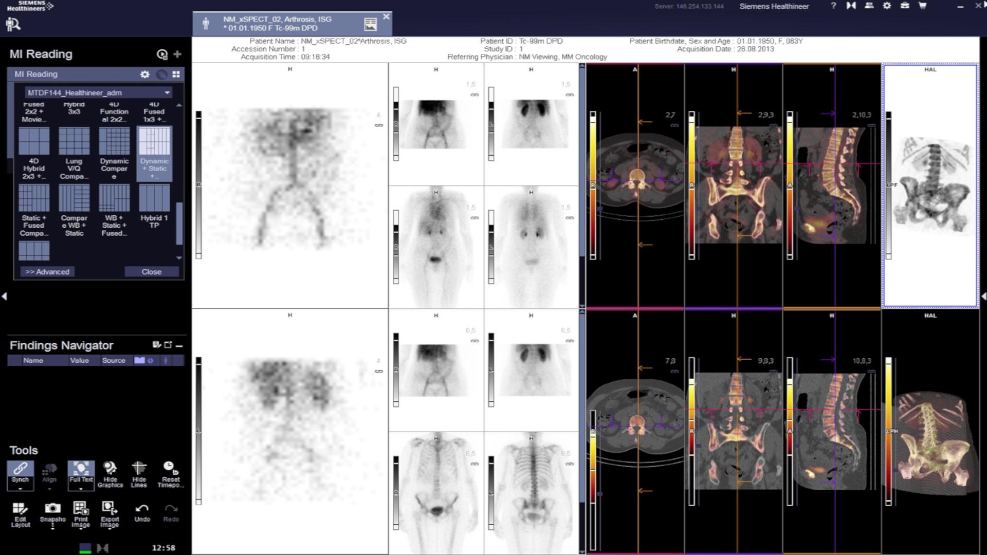 syngo.via - Siemens Healthineers USA