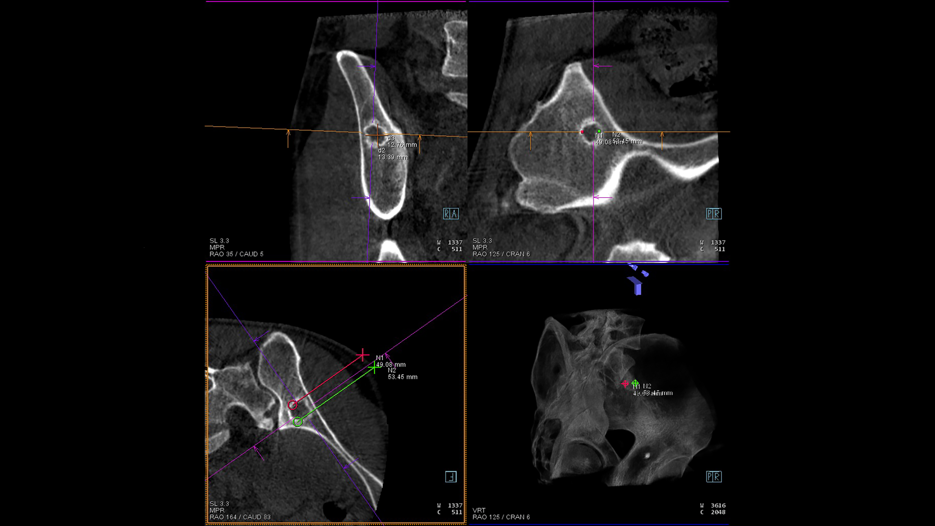 Nexaris Angio-MR-CT - Siemens Healthineers