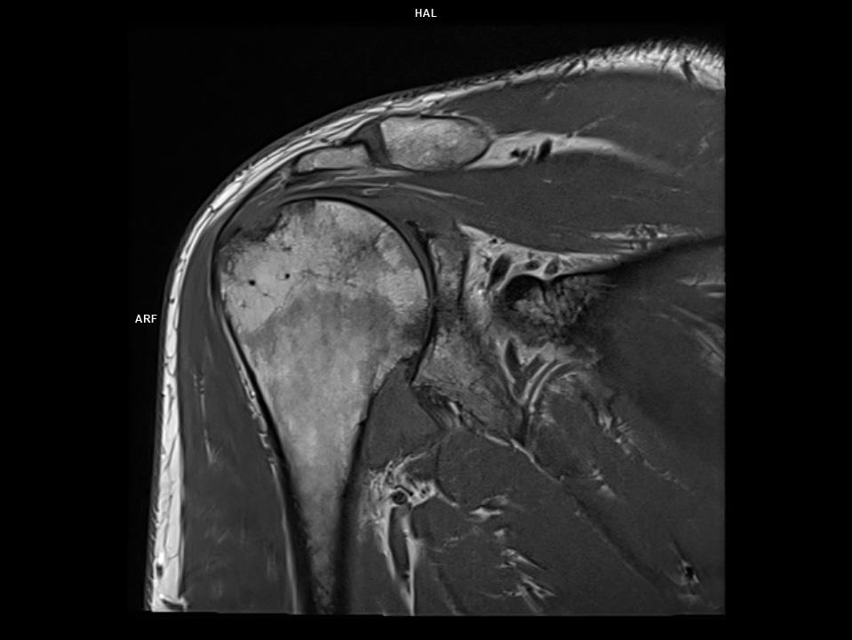 Coronal T1 tse-MAGNETOM Vida - Siemens Healthineers USA