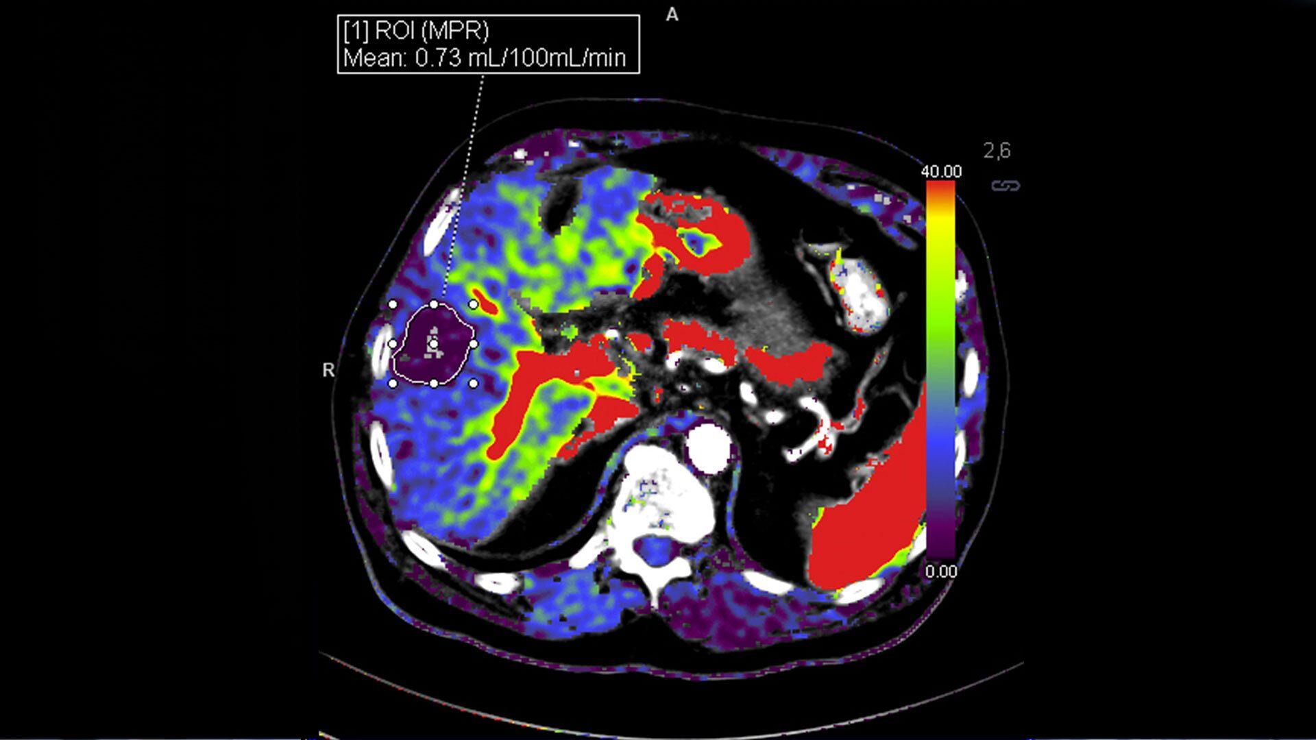 Nexaris Angio-CT - Siemens Healthineers