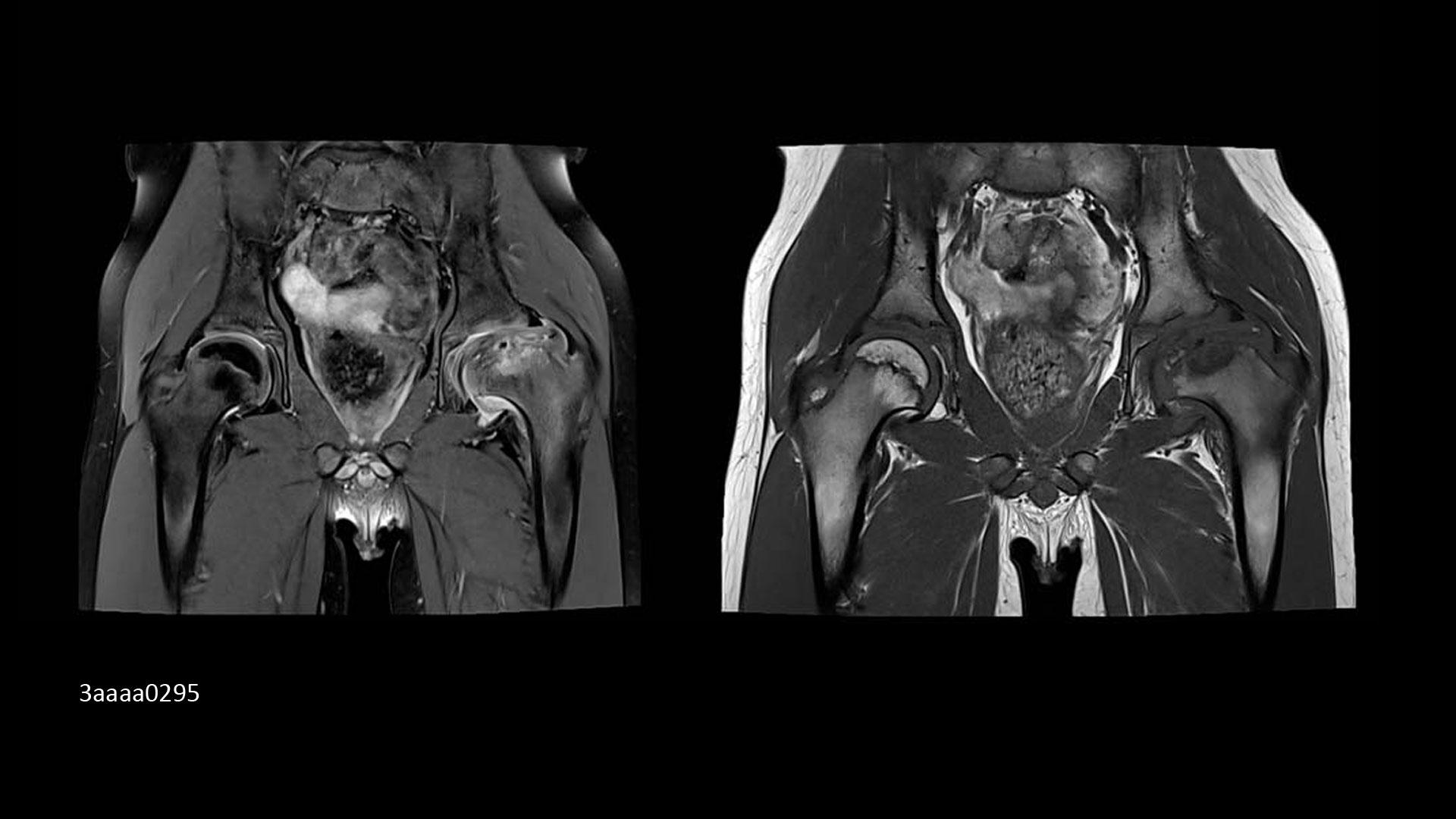 MAGNETOM Vida - Leading the field - Siemens Healthineers