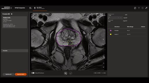 AI-Rad Companion Prostate MR