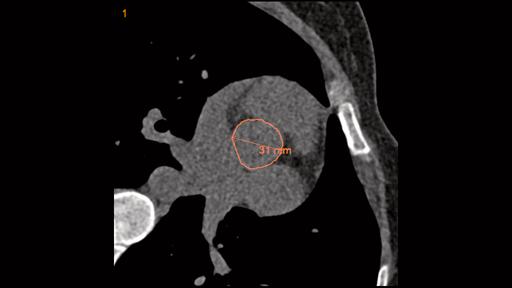 AI-Rad Companion - Siemens Healthineers USA