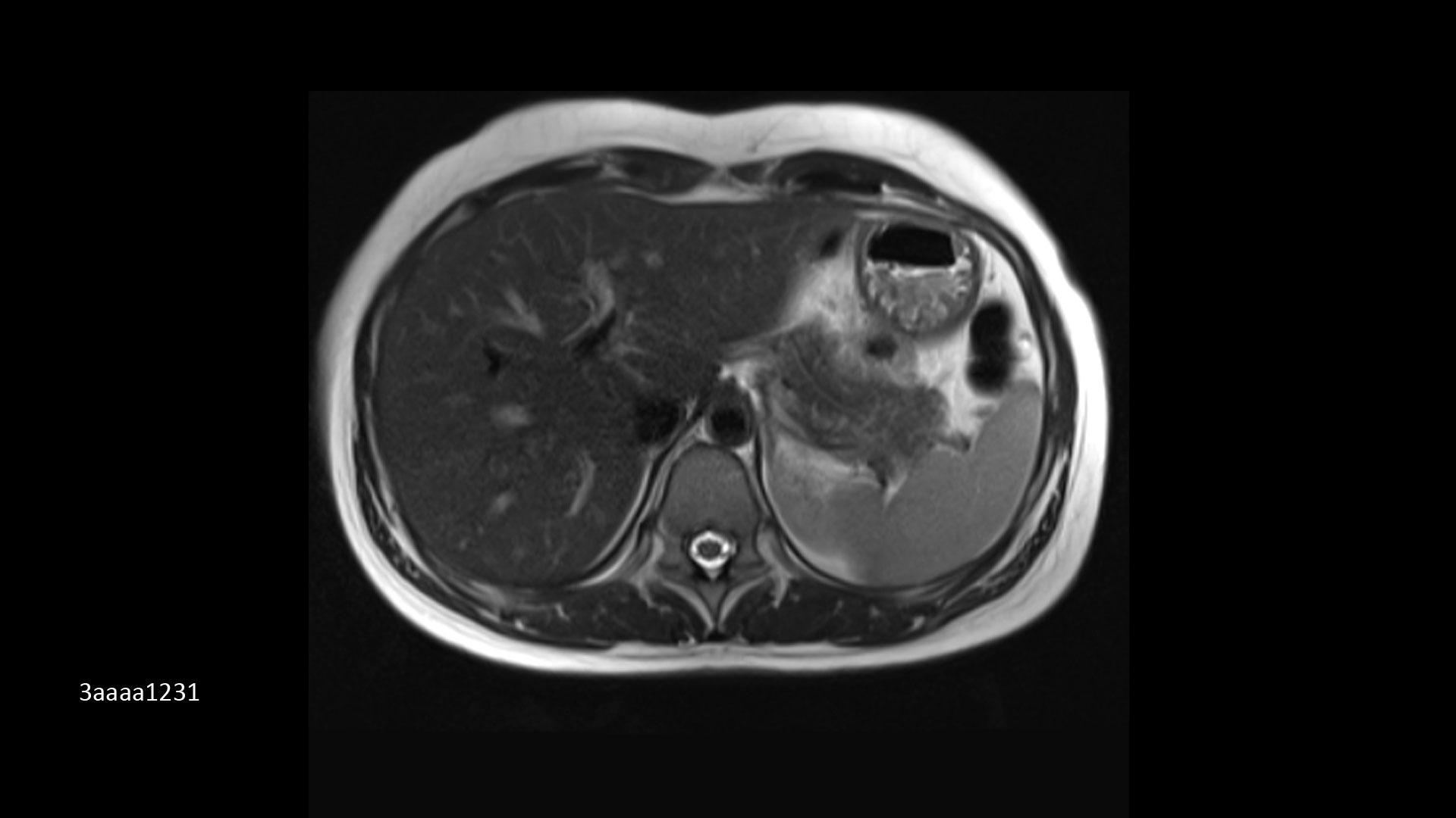 MAGNETOM Vida - Siemens Healthineers USA