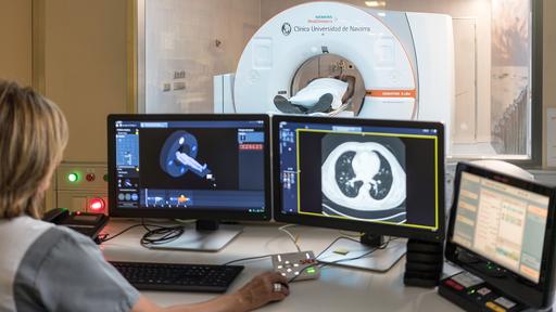 Simplifying Even Complex CT Procedures with Intelligent Imaging ...