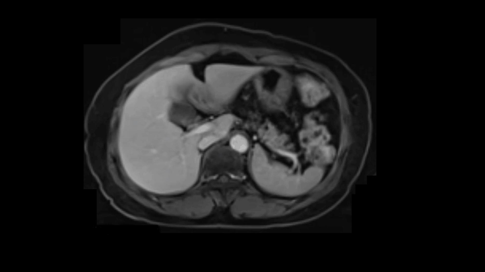 MAGNETOM Vida - Siemens Healthineers USA