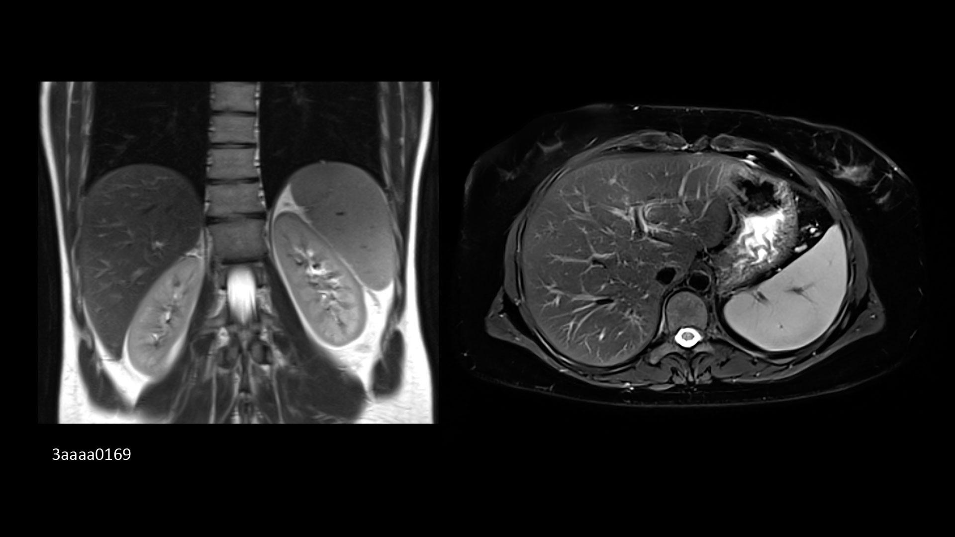MAGNETOM Vida Pro Edition - Elevated MRI Experience. - Siemens ...