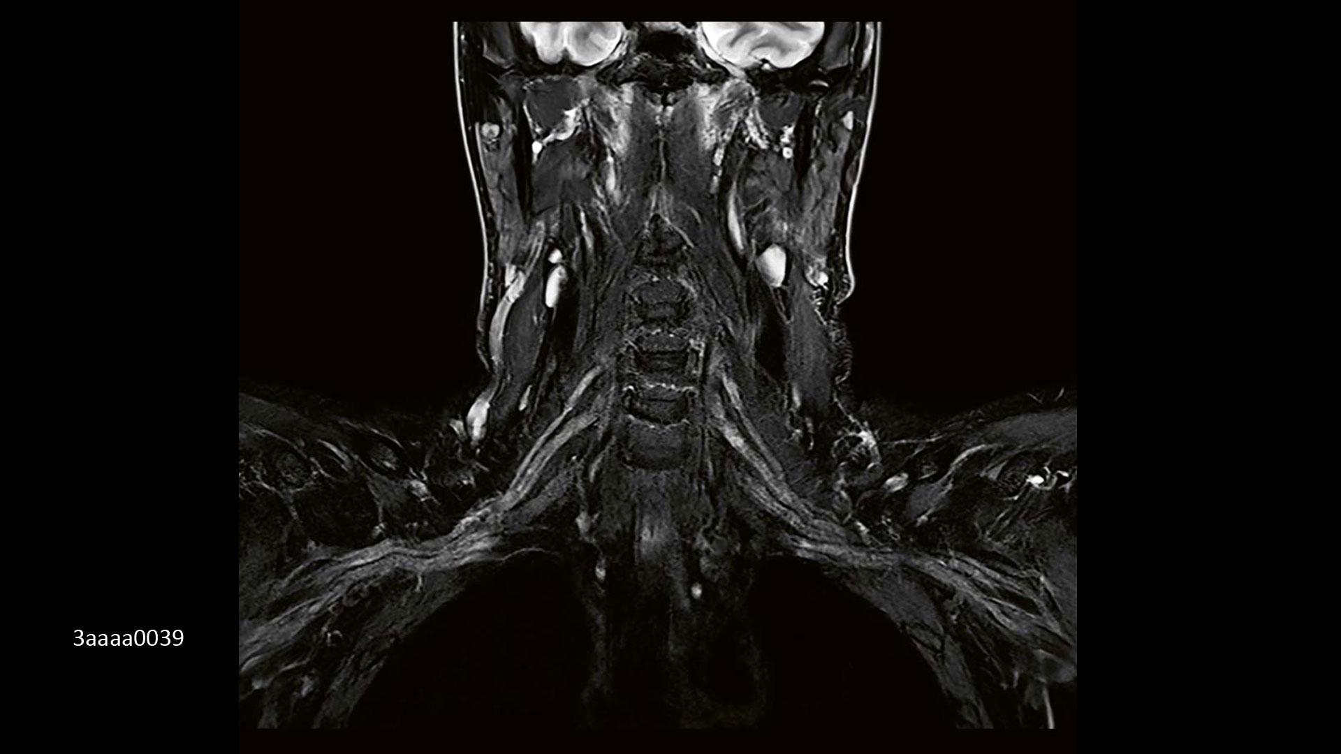 MAGNETOM Vida - Siemens Healthineers USA