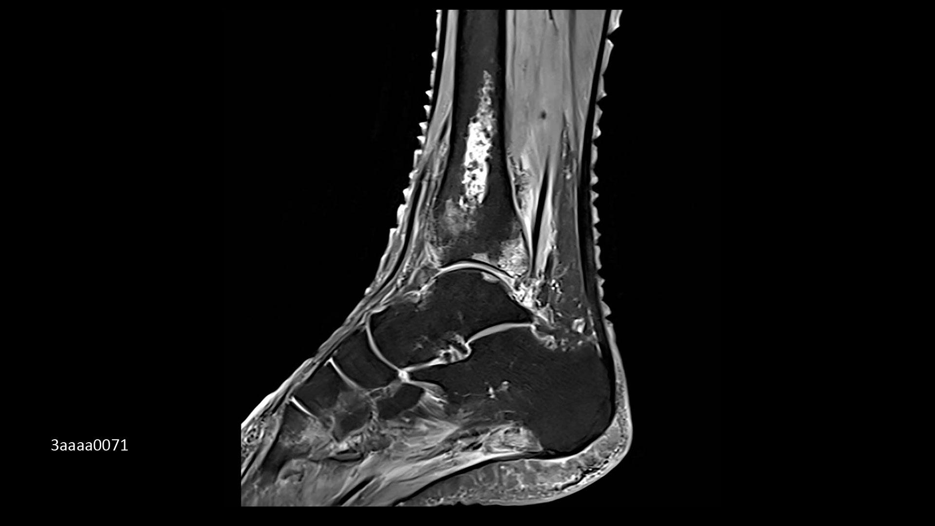 MAGNETOM Vida - Leading the field - Siemens Healthineers