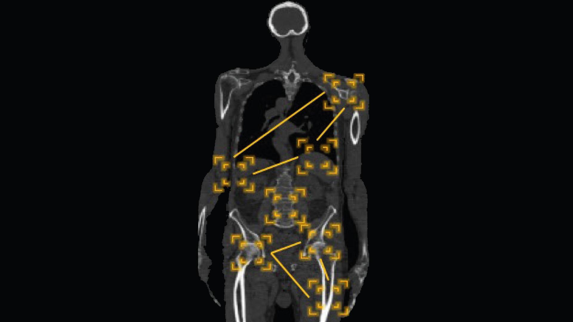 Patient pathways for guided CT imaging - Siemens Healthineers Vietnam
